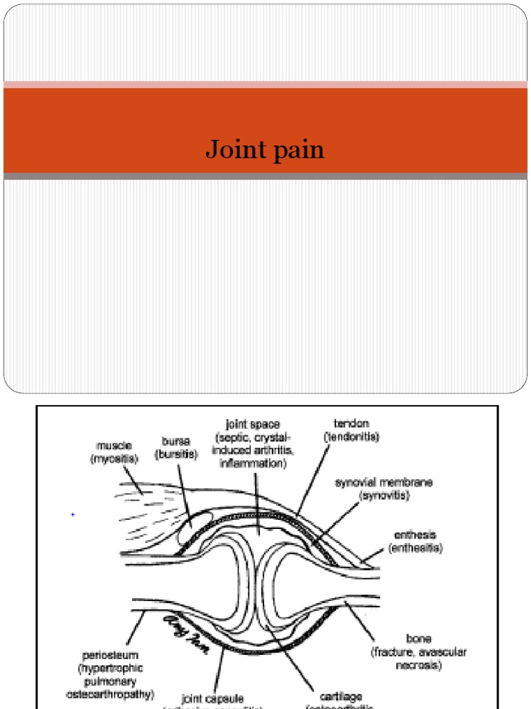 Joint Pain | PDF | Arthritis | Rheumatoid Arthritis