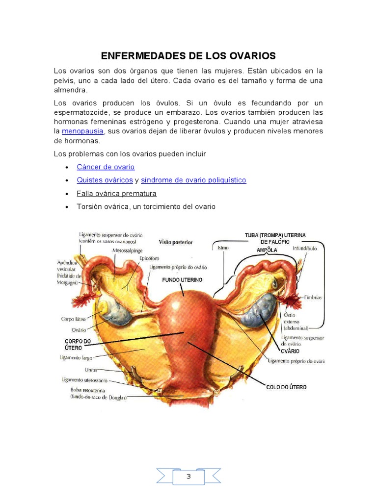 Enfermedades de Los Ovarios | PDF | Cáncer de ovarios | Ovario