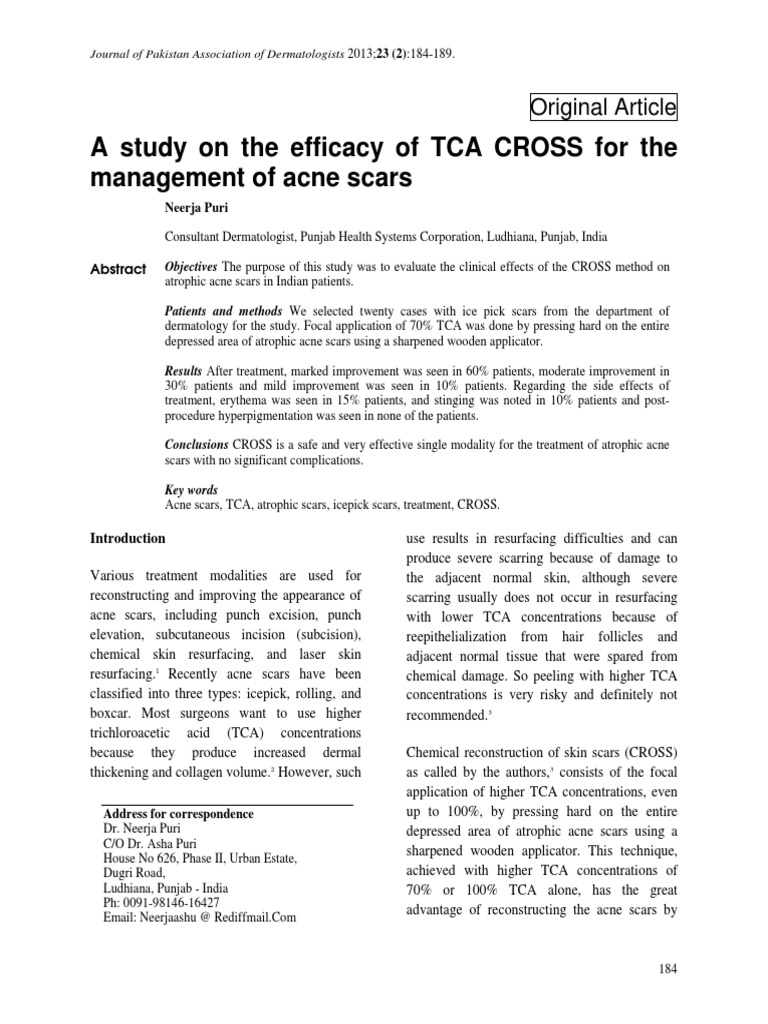 Original Article Efficacy of TCA CROSS For Acne Scars | PDF | Scar ...