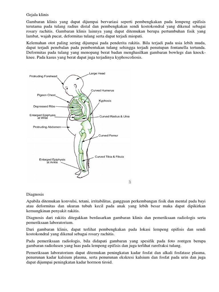 Rakitis | PDF | Kesehatan Holistik | Sains & Matematika