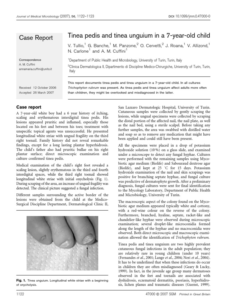 Tinea Pedis and Tinea Unguium in 7 Yo Children | Animal Diseases ...