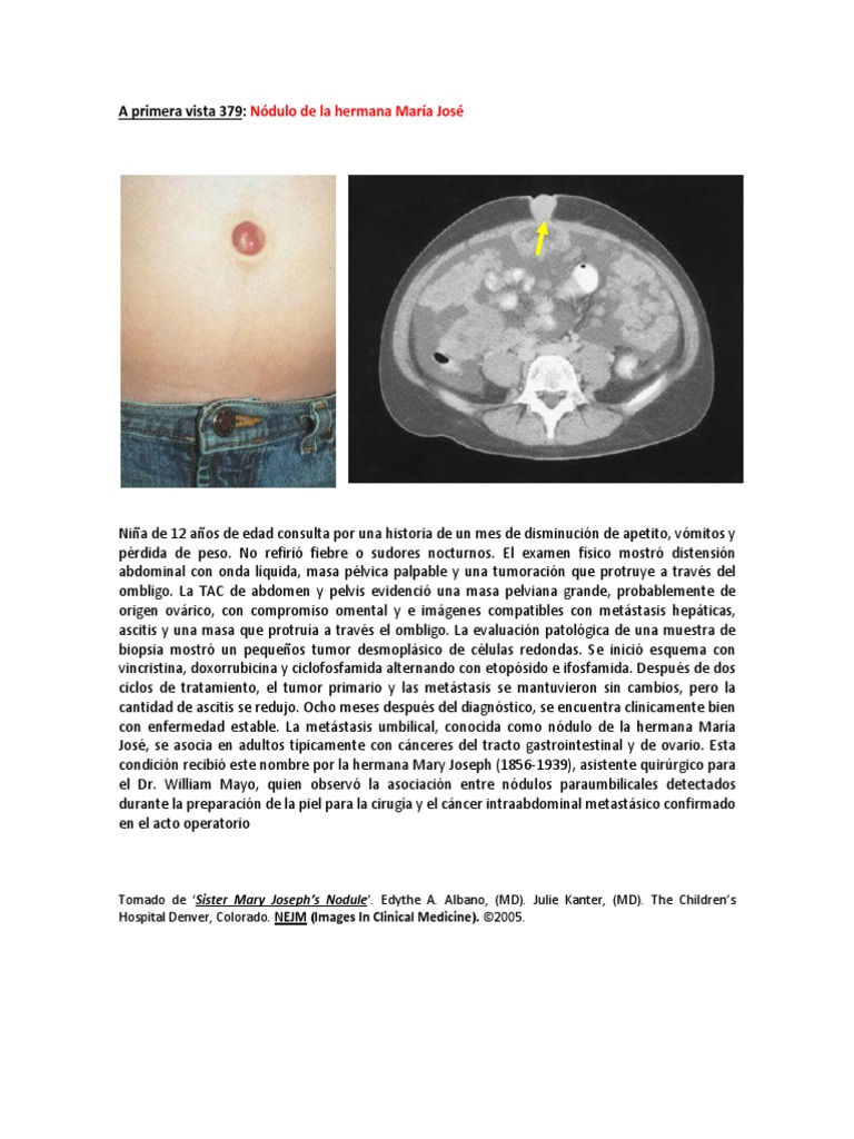 A Primera Vista 379 (Nódulo de La Hermana María José) | PDF