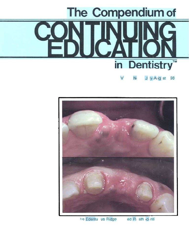 Ridge Defects and Pontic Design | PDF | Dental Degree | Dentistry Branches