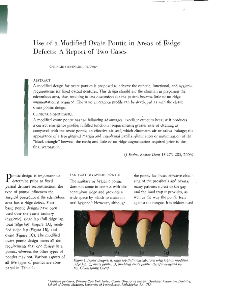 Modified Pontic Design for Ridge Defects | Dentures | Medical Specialties