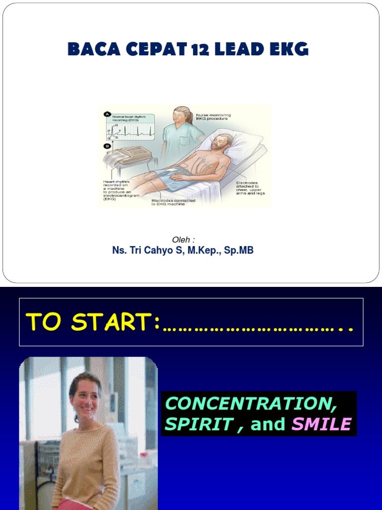 Baca Cepat Ekg 12 Lead | PDF