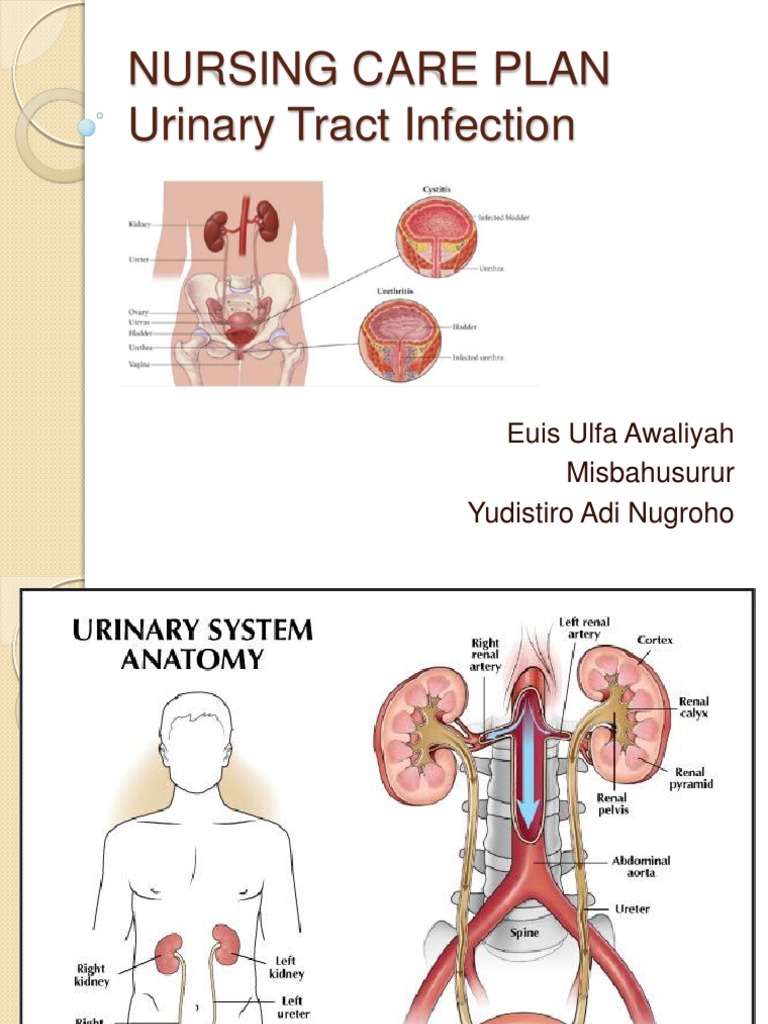 NCP Urinary Tract Infection | Urinary Tract Infection | Urinary System