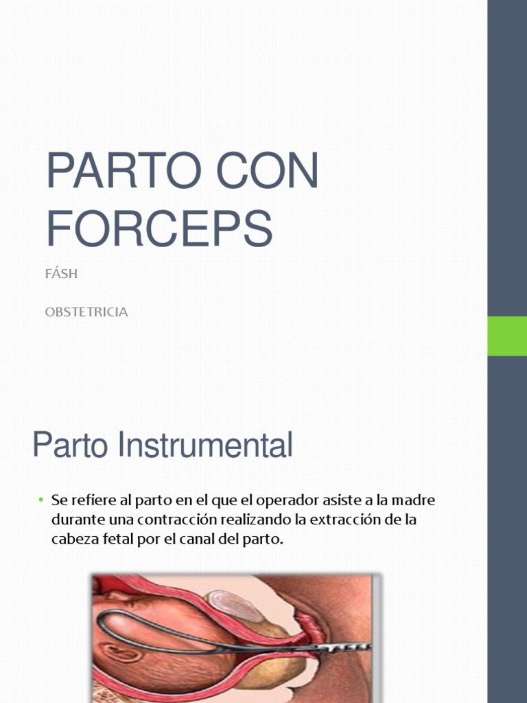 Parto con Fórceps: Indicaciones y Tipos | PDF | Pelvis | Parto