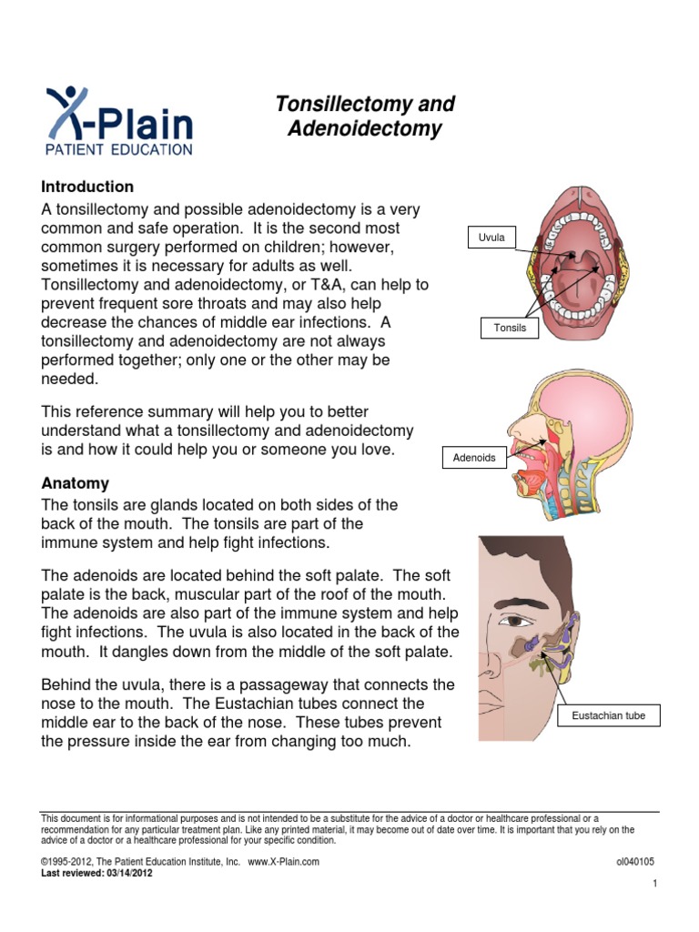 Tonsillectomy and Adiniodectomy | PDF | Surgery | Health Care