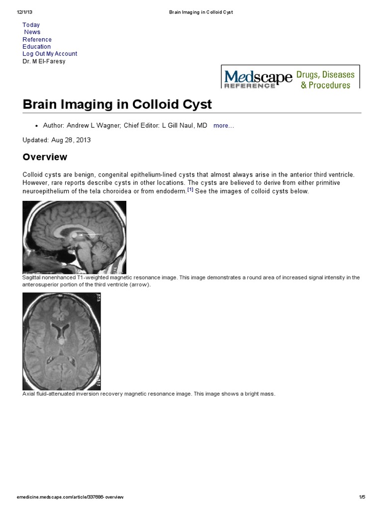 Brain Imaging in Colloid Cyst | Radiology | Magnetic Resonance Imaging
