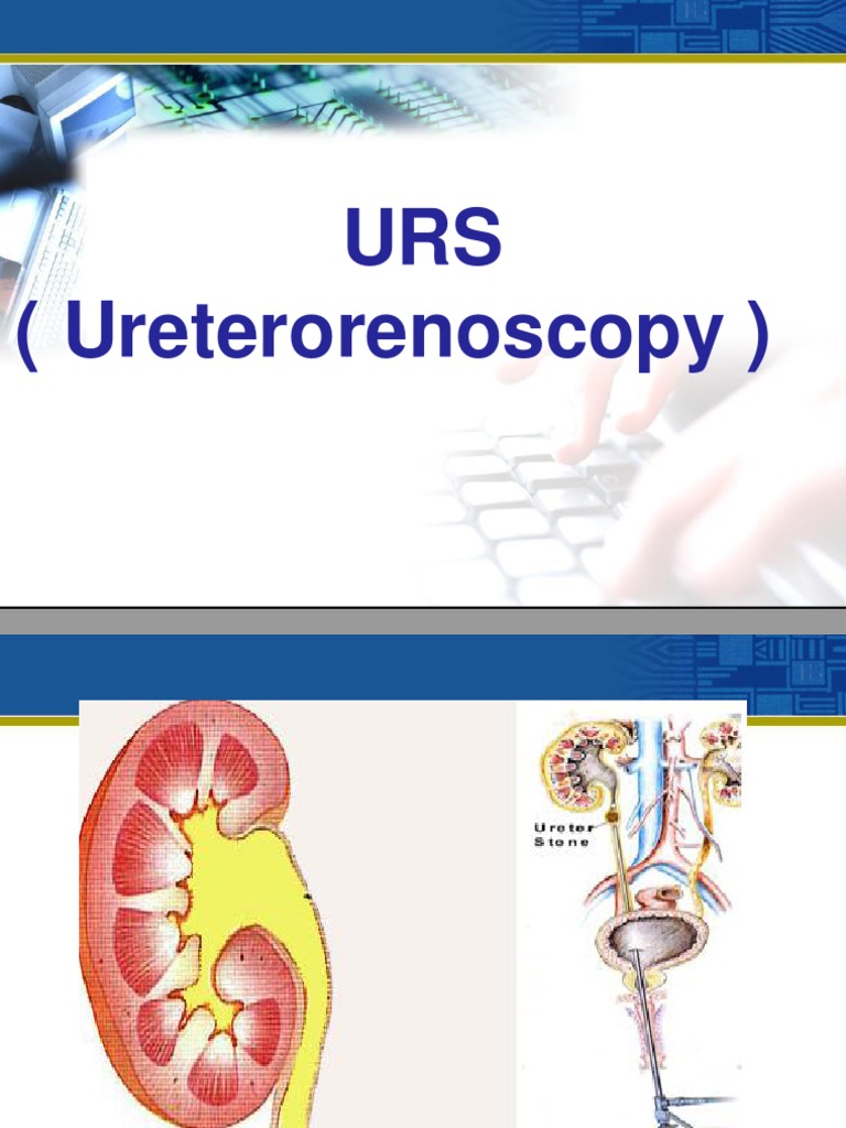 URS (Ureterorenoscopy) | PDF