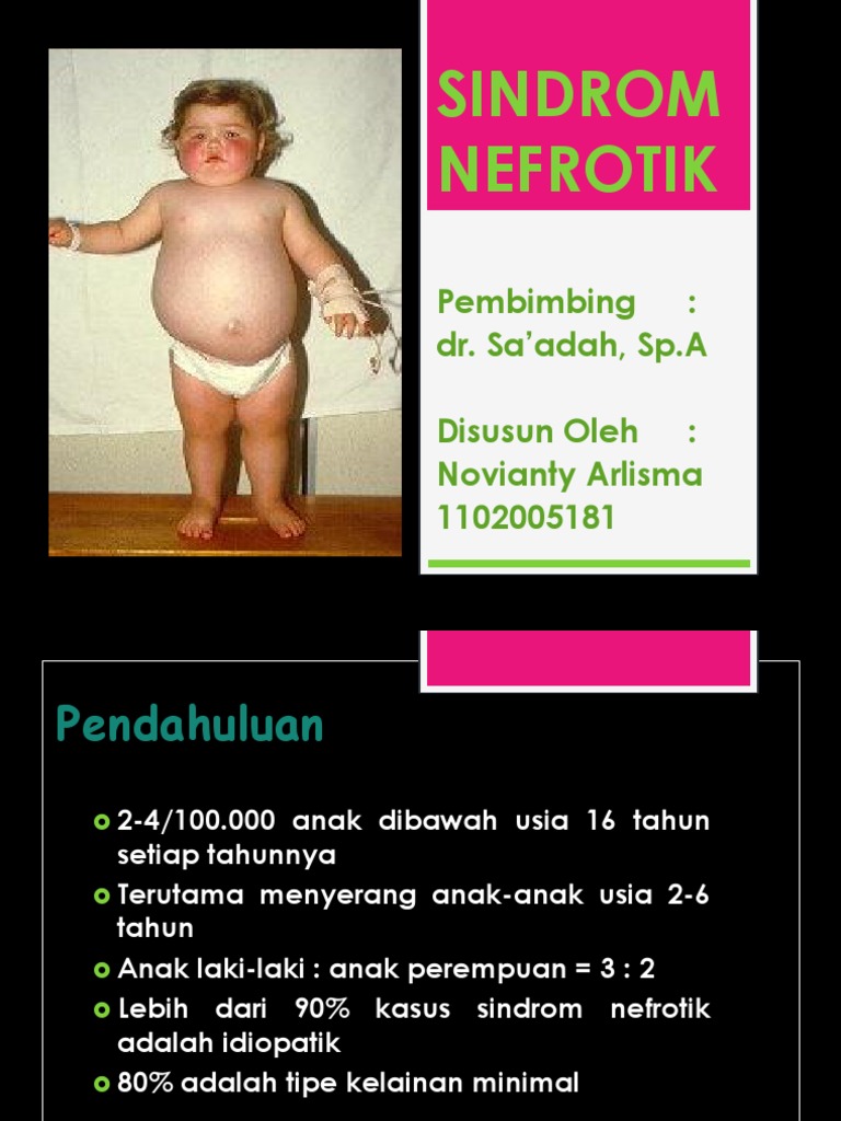 Sindrom Nefrotik | PDF