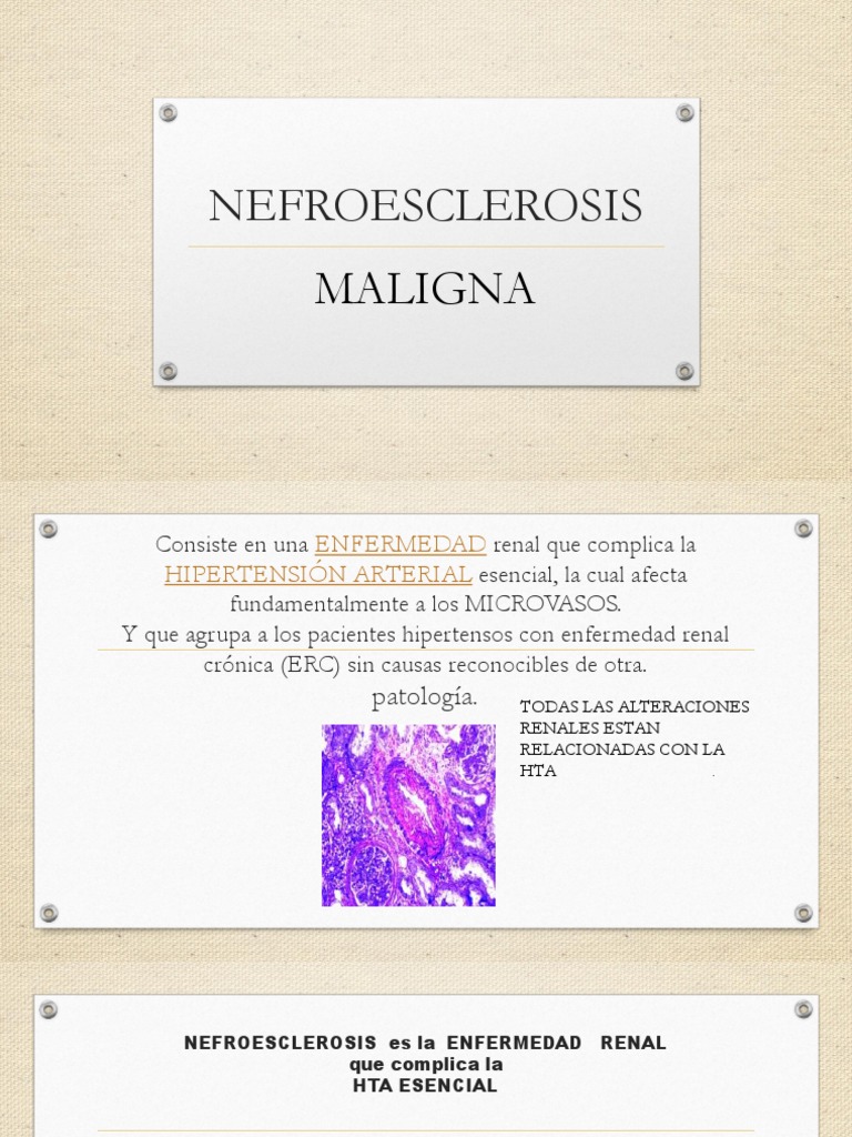 Nefroesclerosis Maligna y Hipertensión | PDF | Hipertensión ...