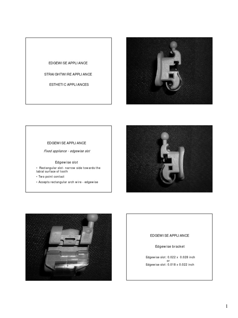 Edgewise Appliance Straightwire Appliance Esthetic Appliances | PDF