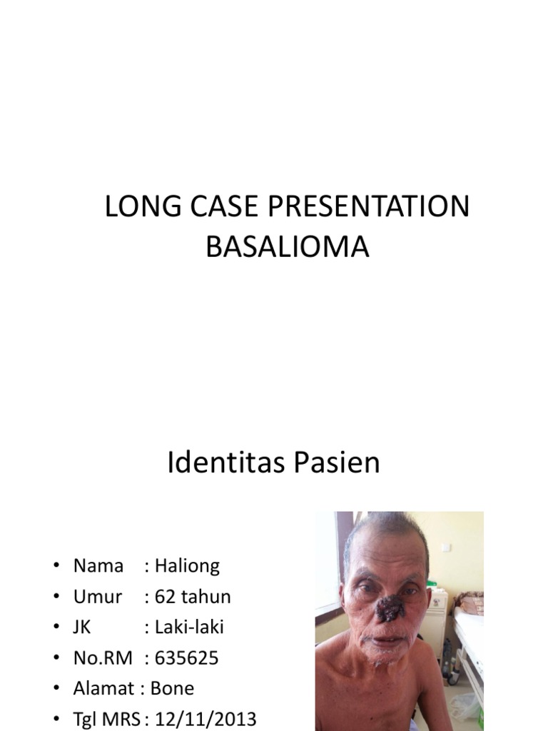 Long Case Presentation Basalioma | PDF