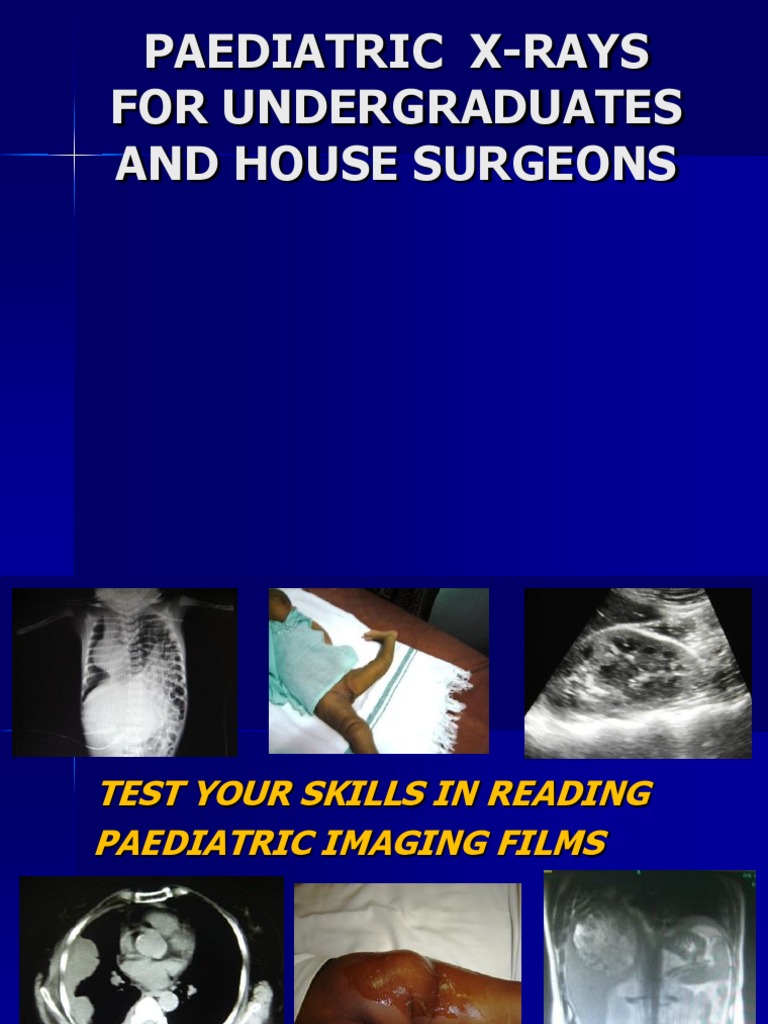 Pediatric x Rays | Lung | Pulmonology