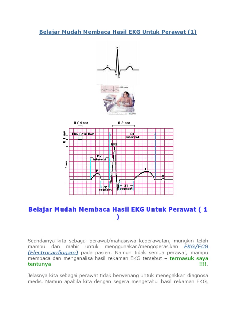 Belajar Mudah Membaca Hasil EKG Untuk Perawat | PDF
