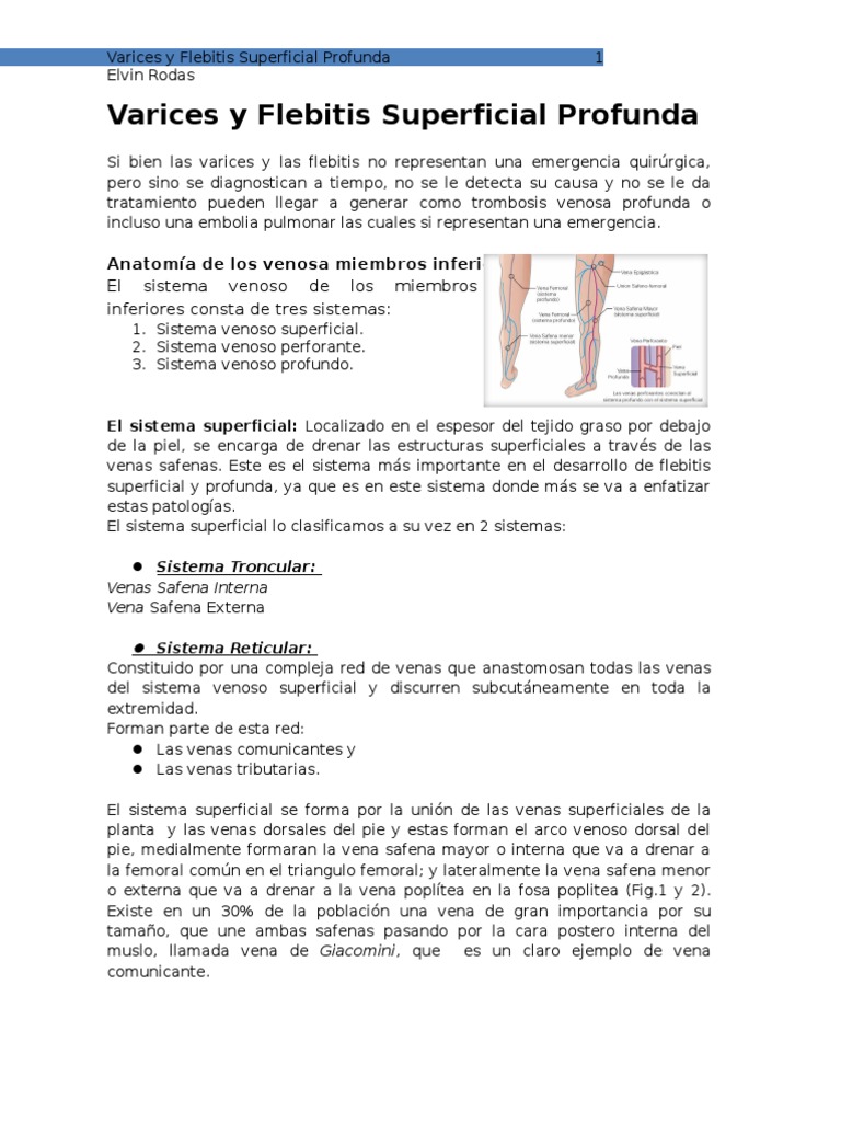 Varices y Flebitis Superficial Profunda CORREGIDA | Descargar gratis ...