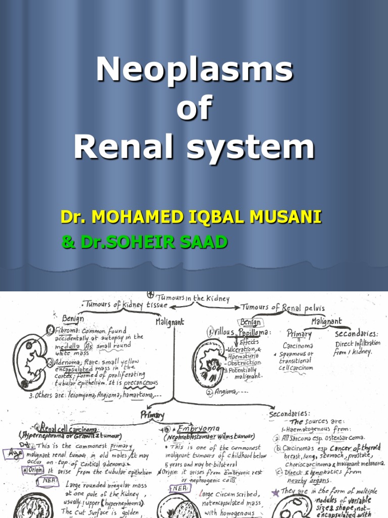 Neoplasms of Renal System | Benign Tumor | Kidney