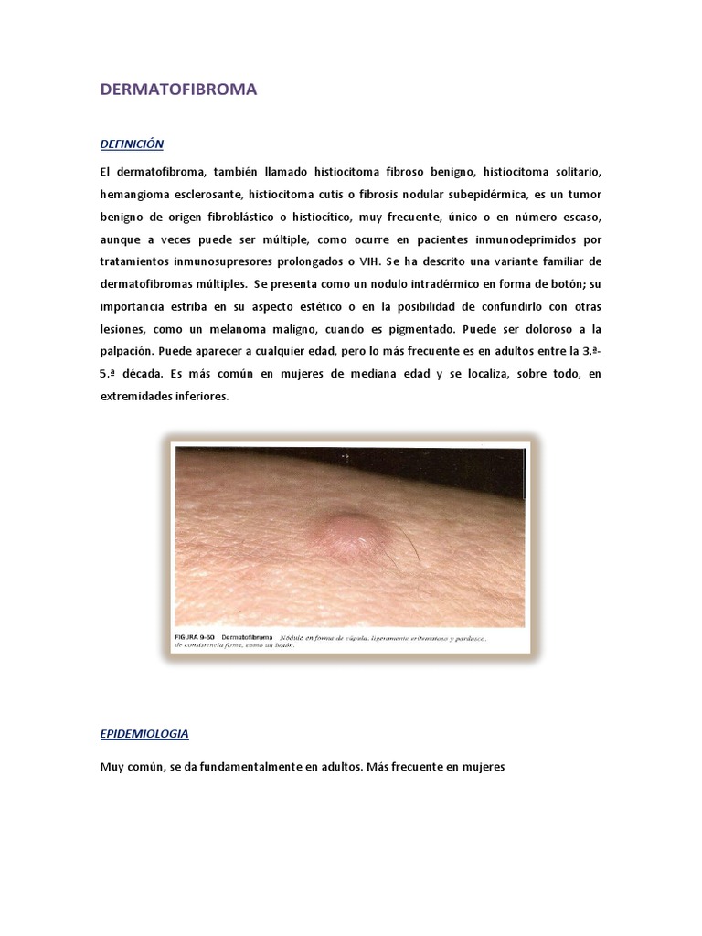 Caracterización clínica y patológica del dermatofibroma, un tumor ...