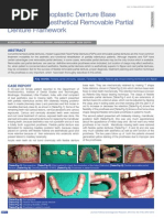 Design of Chrome Cobalt RPD | PDF | Dental Anatomy | Dentistry
