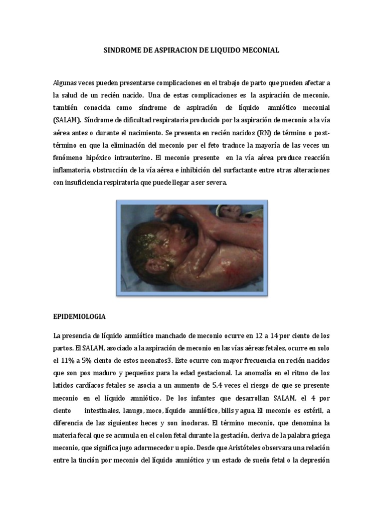 Sindrome de Aspiracion de Liquido Meconial | PDF | Medicina CLINICA ...