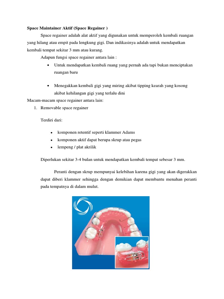 Space Regainer: Fungsi dan Jenis | PDF