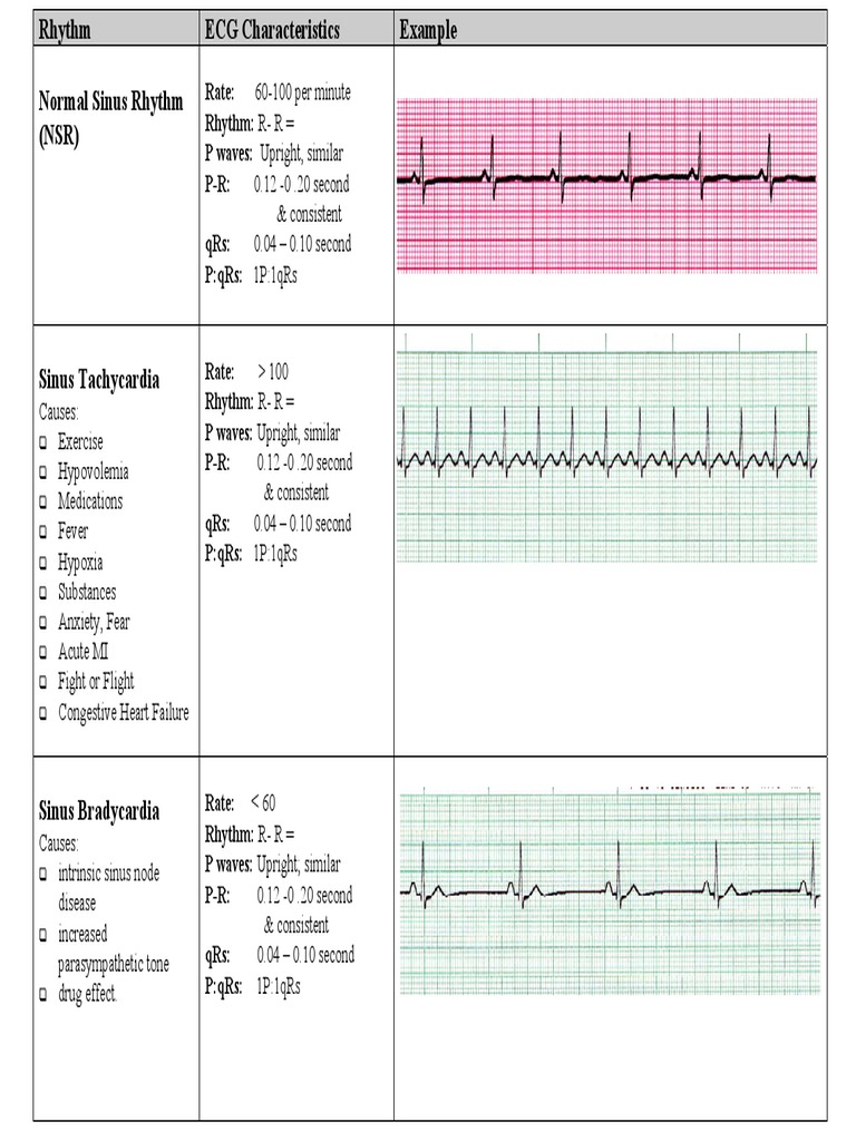 EKG Flash Chart | PDF | Electrocardiography | Cardiovascular System