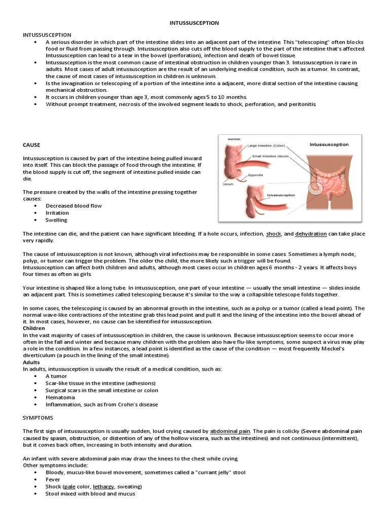 Intussusception | PDF | Medicine | Clinical Medicine