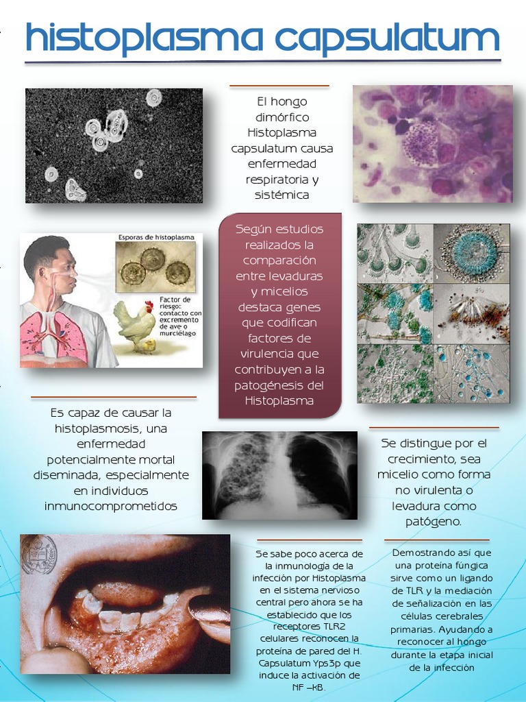 Histoplasma capsulatum: Patogenia y síntomas | PDF | Ciencia y matemáticas