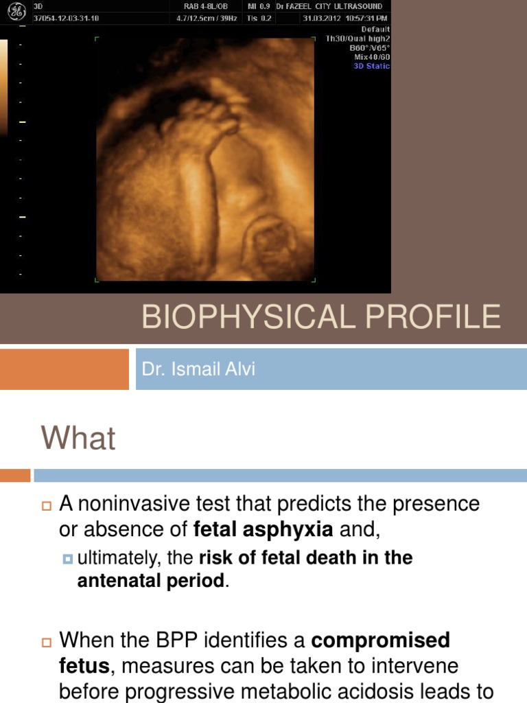 Biophysical Profile Antenatal Ultrasound | Childbirth | Anatomical ...