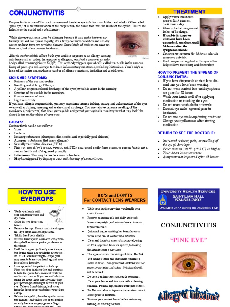 Red Eye | PDF | Contact Lens | Allergy