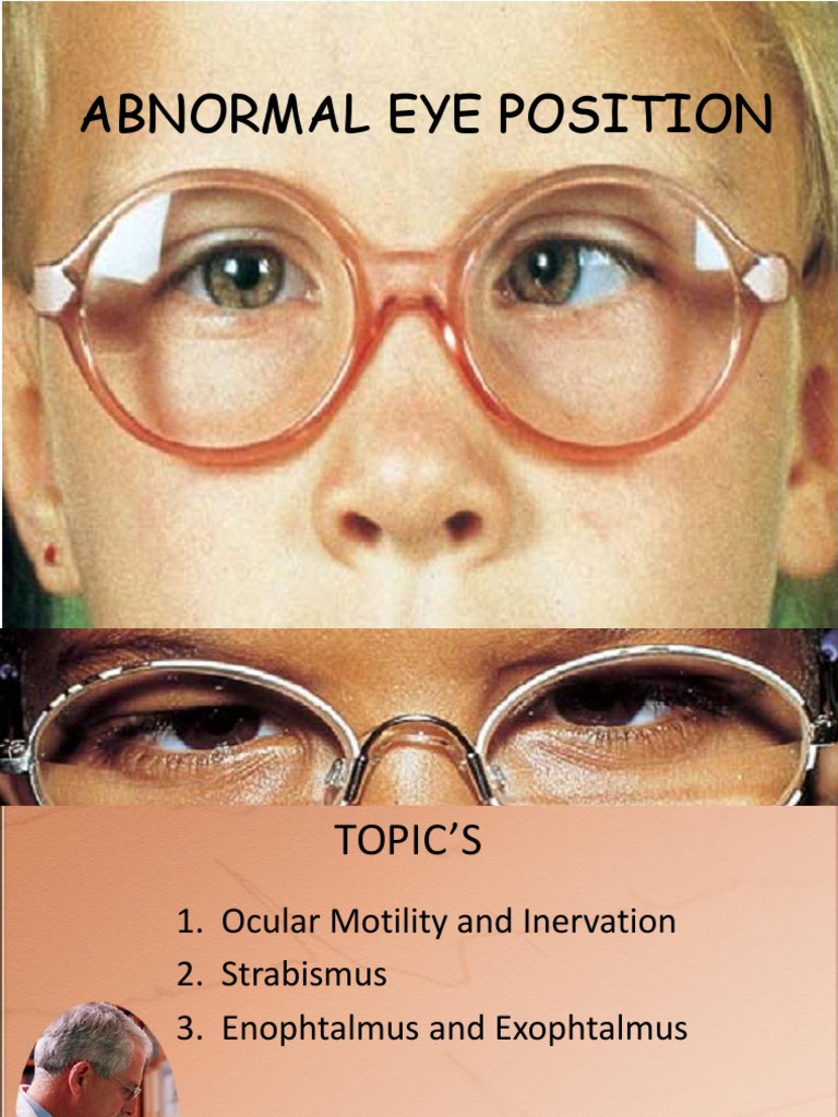 Abnormal Eye Position | PDF | Human Eye | Diseases Of The Eye And Adnexa