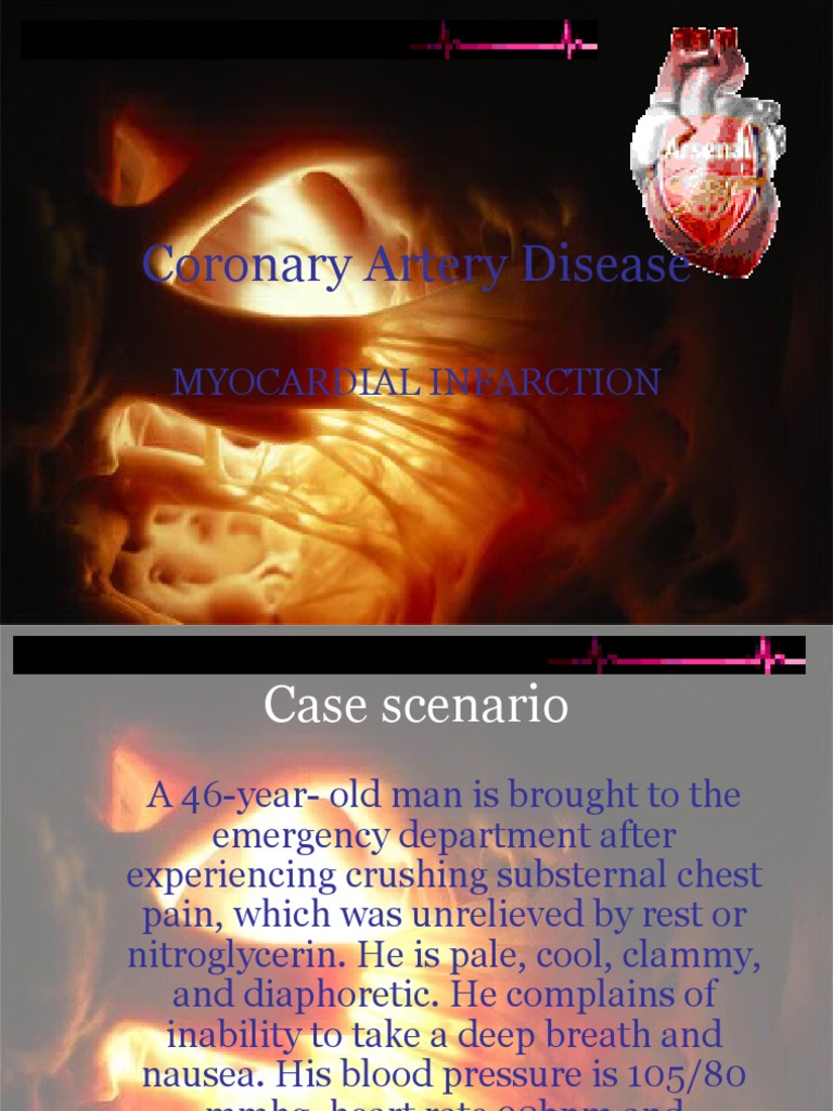 Coronary Artery Disease | PDF | Lactate Dehydrogenase | Heart