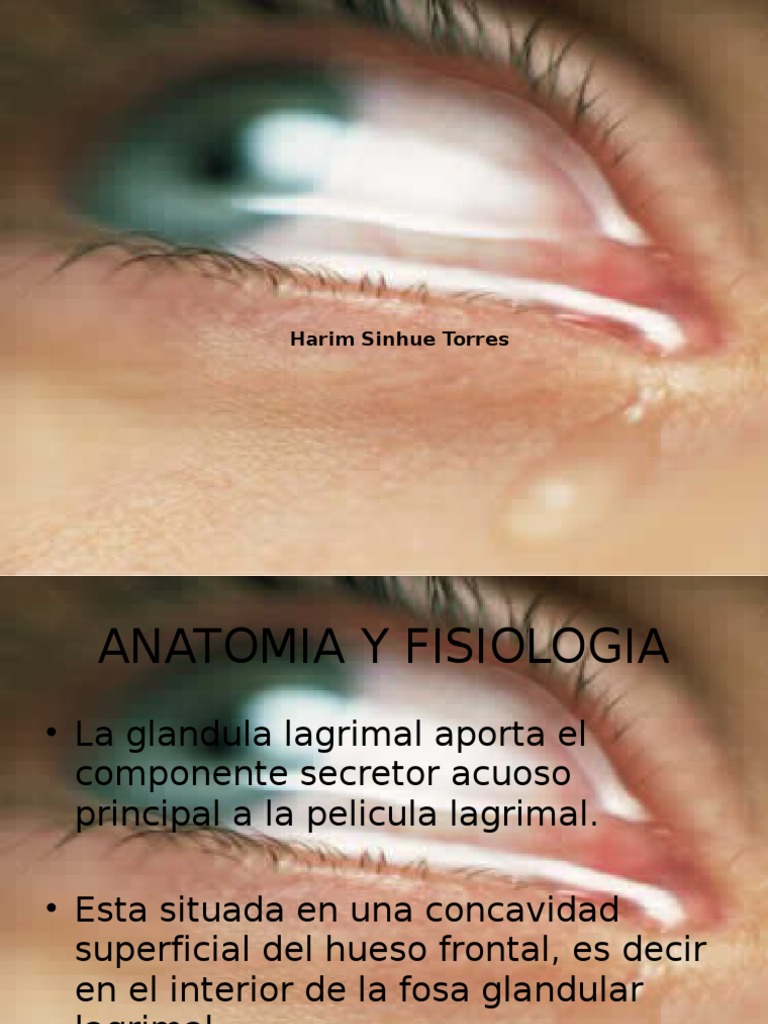 Vias Lagrimales y Dacrioadenitis | PDF | Córnea | Inflamación