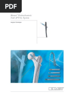t2-st-25 Rev-1 t2 Alpha Femur-Antegrade GT Nailing System | PDF ...