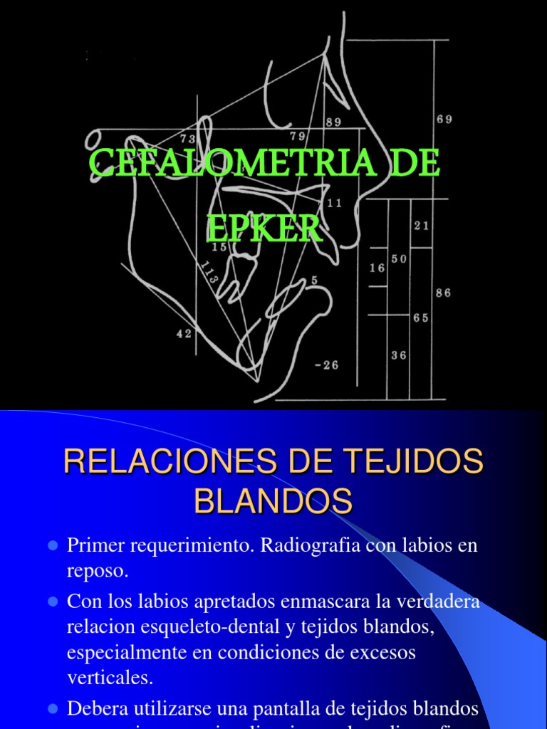 Cefalometria de Epker