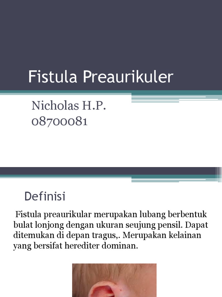 Fistula Preaurikuler | PDF