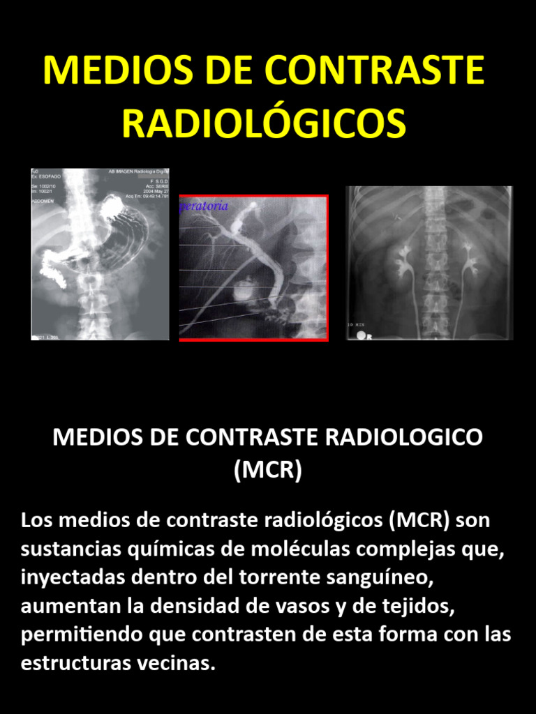Propiedades y clasificación de los medios de contraste radiológicos ...
