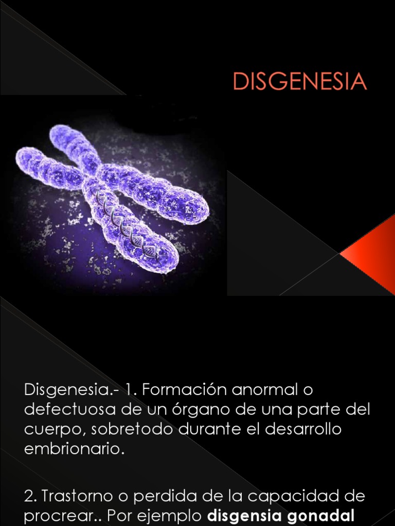 DISGENESIA | Cromosoma | Especialidades Medicas