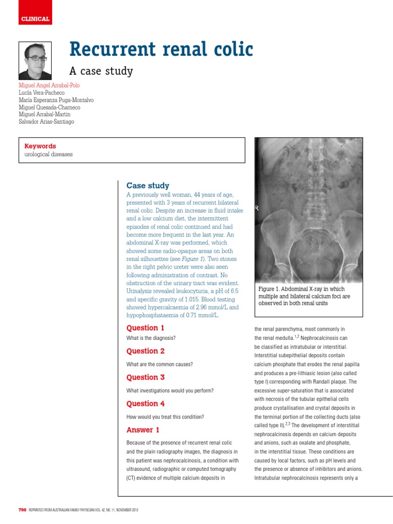 Recurrent Renal Colic: A Case Study | PDF | Kidney | Organ (Anatomy)
