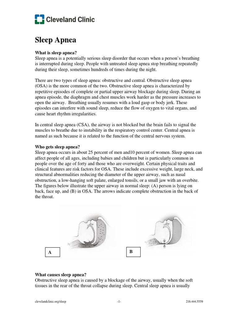 Sleep Apnea Journal | PDF | Sleep Apnea | Apnea