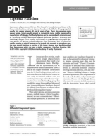 Lucid Interval | PDF | Traumatic Brain Injury | Surgical Specialties