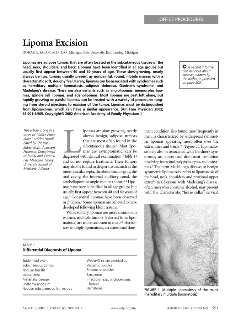 Lipoma Excision | Surgery | Medical Specialties