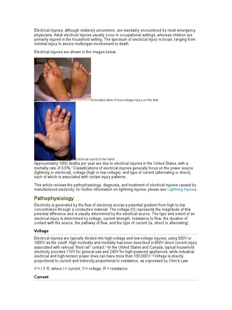 Electrical Injury Pathophysiology & Treatment | PDF