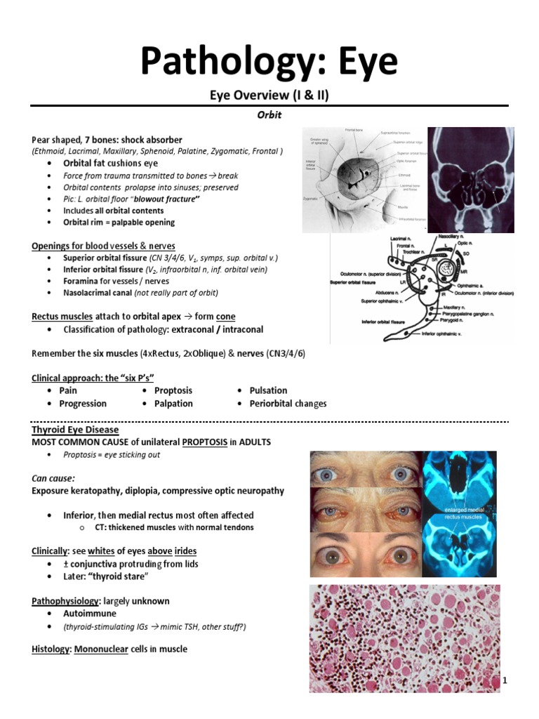 Eye - Pathology | Retina | Glaucoma