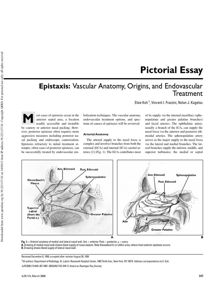 Epistaxis Vascular Anatomy, Origins, and Endovascular Treatment | PDF ...