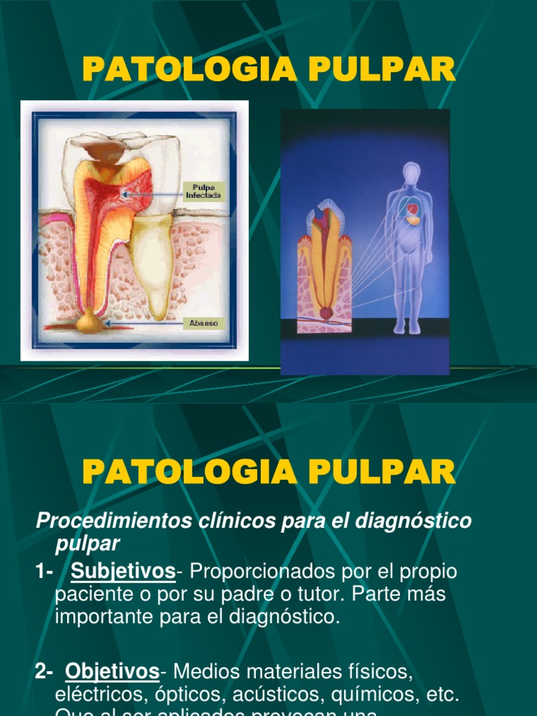ENFERMEDADES PULPARES | Inflamación | Inmunología