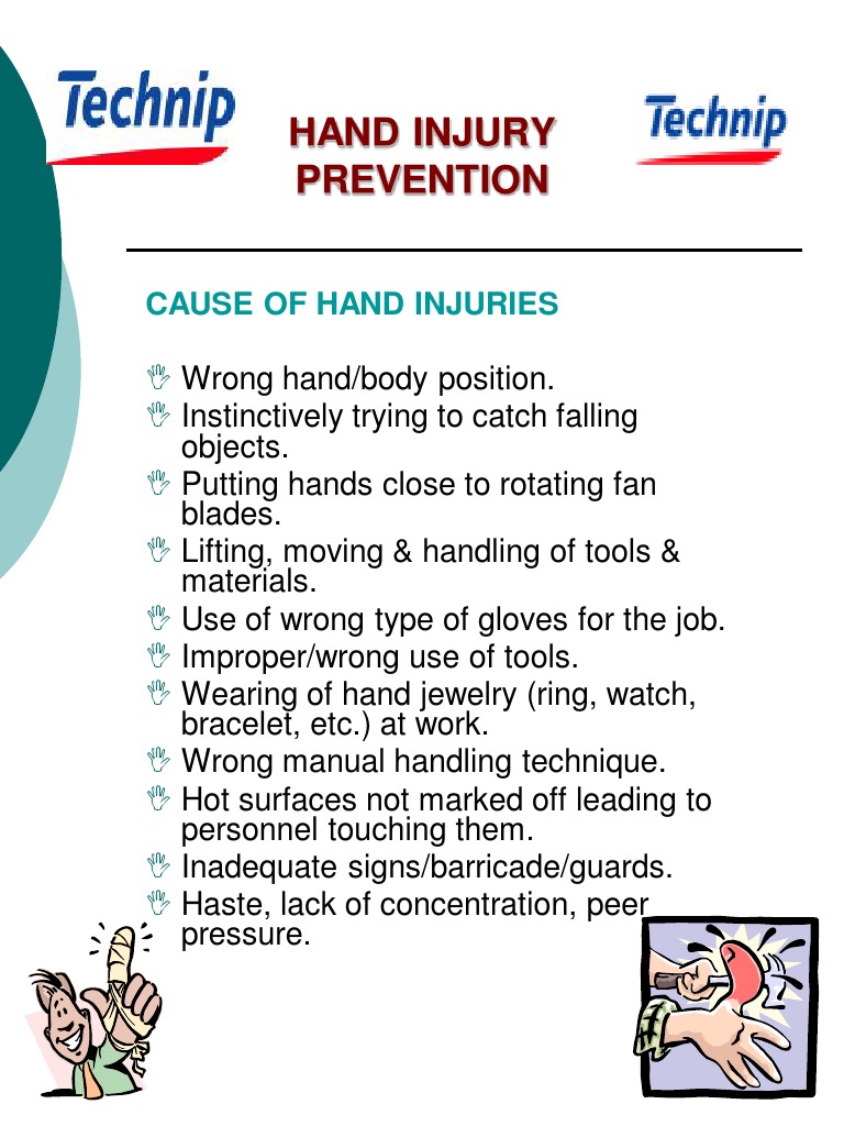Hand Injury Prevention | PDF | Wellness