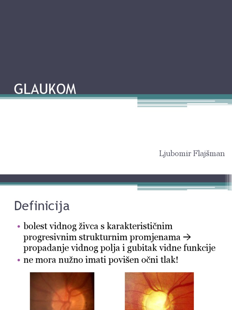 GLAUKOM | PDF