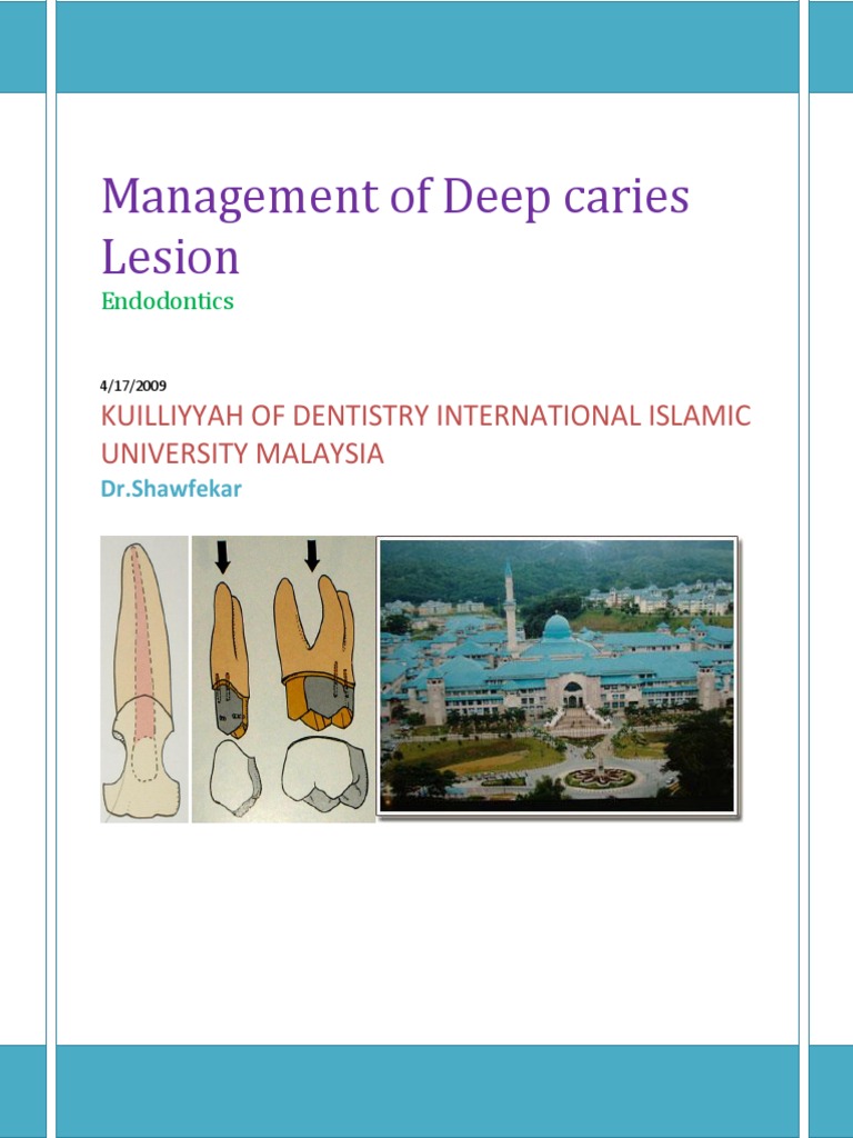 Management of Deep Caries Lesion | PDF | Human Tooth | Dentistry